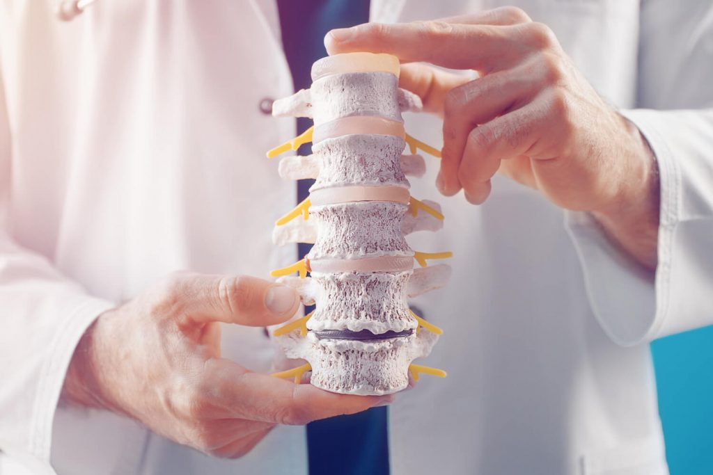 Artrodesis lumbar: Qué es, secuelas y tratamiento | Fisiofine